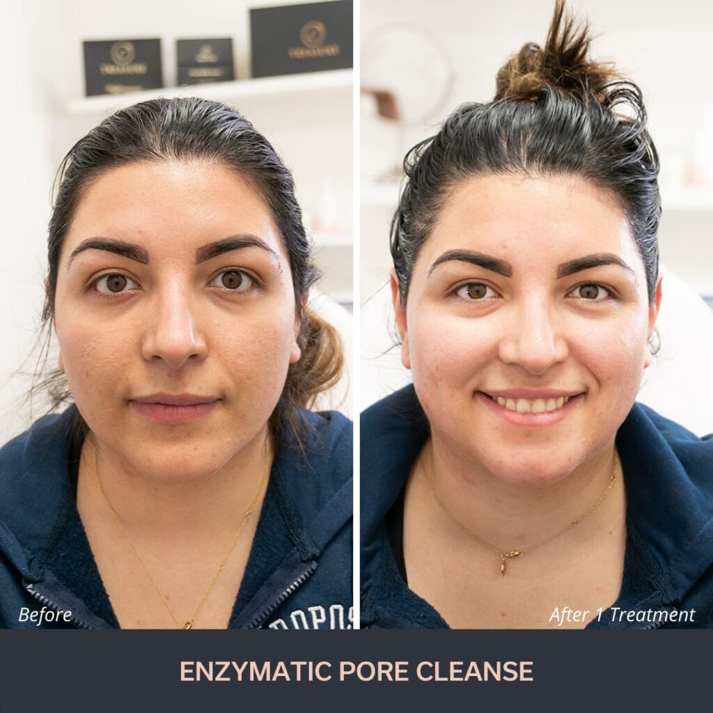 Galvanic current - Novuskin